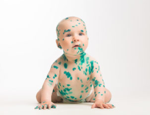 Treating baby rashes: a Singapore doctor’s guide to heat rash, eczema ...